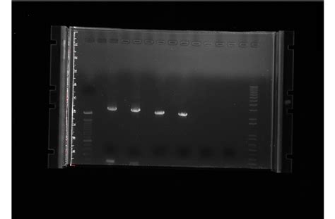 Can Anyone Help With A Gel Extraction Question Researchgate