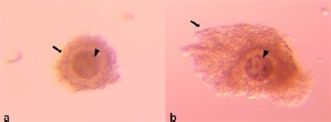 Figure 1 From Deep Learning Based Quantification Of Bovine Oocyte