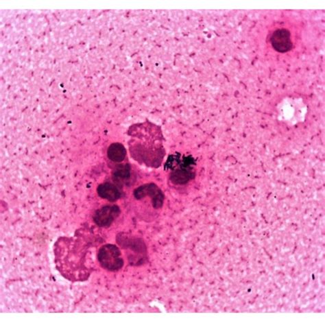 General Features Of The Genome Sequences Of C Ulcerans Frc11 And C
