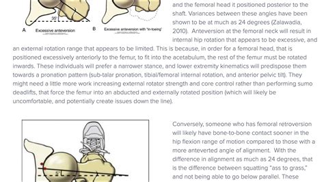 Hip Anteversion Test