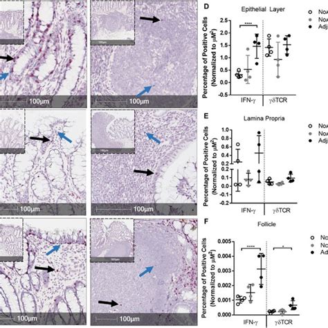 Increased Lymphoid Structures In Rectoanal Junction Of Vaccinated And Download Scientific