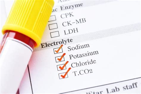 Electrolytes And Ketogenic Dieting Your Complete Guide Keto Science