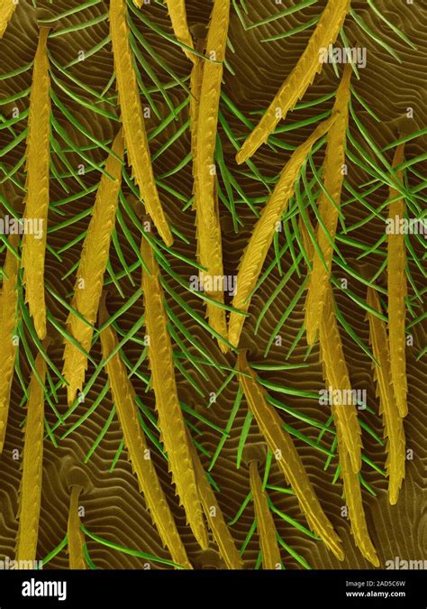 Coloured Scanning Electron Micrograph Sem Of Diving Bell Spider Abdomen Setae Argyroneta