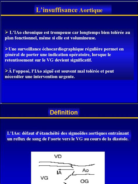 Insuffisance Aortique Pdf Médecine Clinique Spécialités Médicales