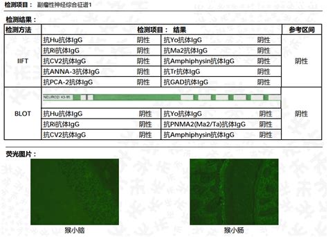 以心律失常为首发的抗gaba B受体抗体阳性自身免疫性脑炎1例 中华急诊网