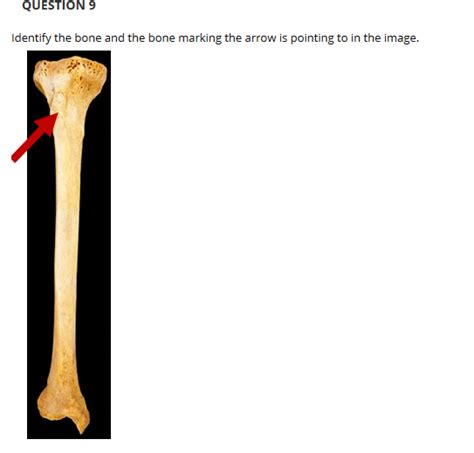 Bone Markings Tuberosity