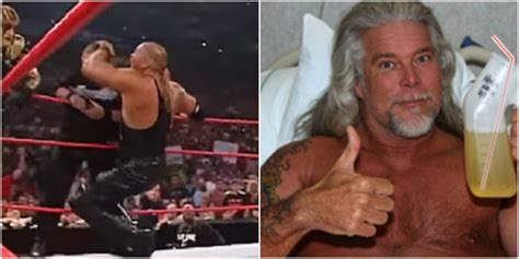 Kevin Nash Knee Wwe Legend Kevin Nash Shows Deformed And Crippled
