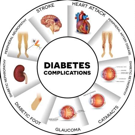 Diabetes Clipart Pathophysiology Picture 2600280 Diabetes Clipart