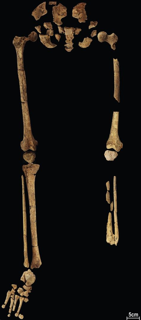 One Legged Stone Age Skeleton May Show Oldest Amputation