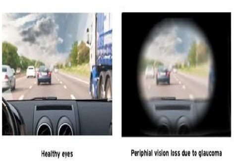 Figure 1 From Glaucoma Detection Using Gan Based Domain Adaptation Approach Semantic Scholar