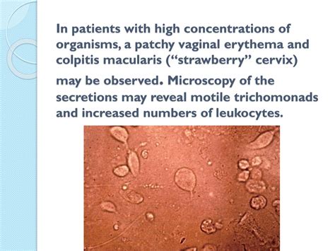Reproductive Tract Infections Ppt Download