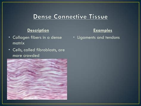 Ppt Connective Tissue Powerpoint Presentation Free Download Id2496030