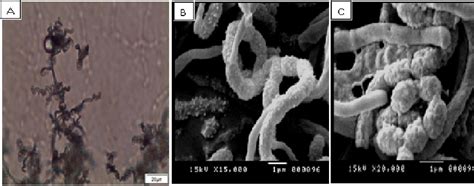 Morphology Of The Recovered Actinomycetes Isolate Asu319 A Mycelia Download Scientific