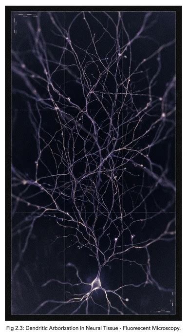 Free Neural Network Architecture Image Neural Dendrites Brain