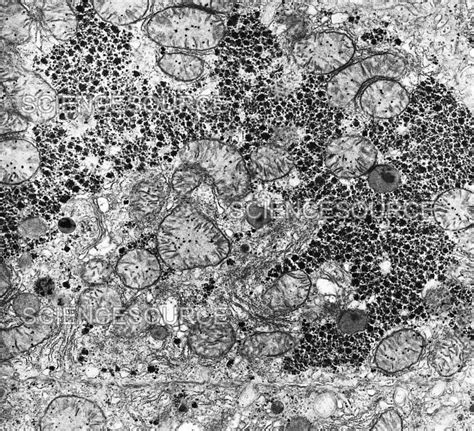 Tem Of Liver Cell Storing Glycogen Stock Image Science Source Images