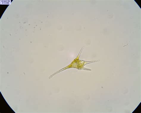Ceratium Microscope