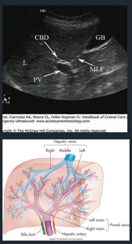 Part 2 Liver Flashcards Quizlet