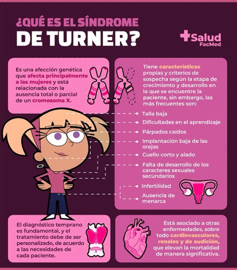 Endocrinóloga ⚠️ ¡el Síndrome De Turner Es Una Condición Genética