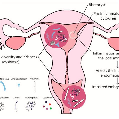 Eubiotic Vaginal And Endrometrial Microbiota Eubiotic Vaginal And