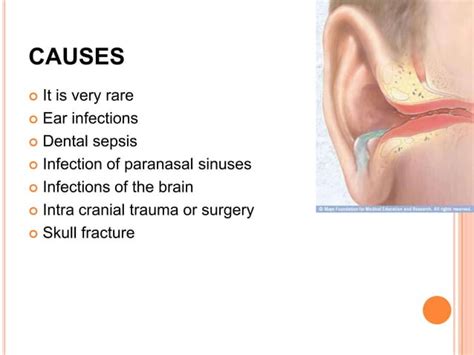 Meningitis Brain Abscess Pptx