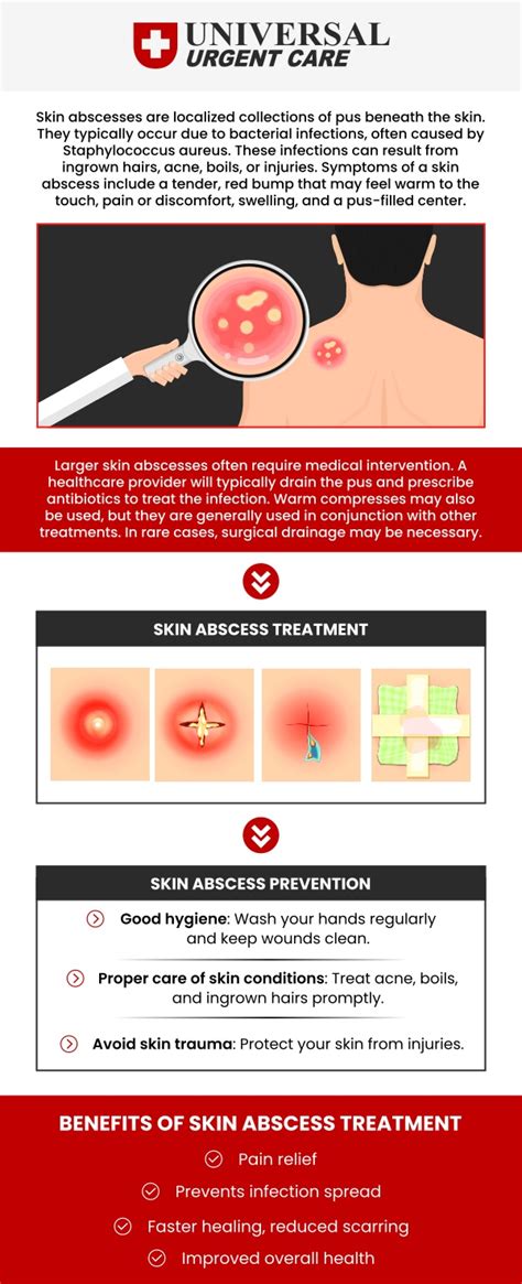 Abscess Treatment Near Me In Bakersfield Ca
