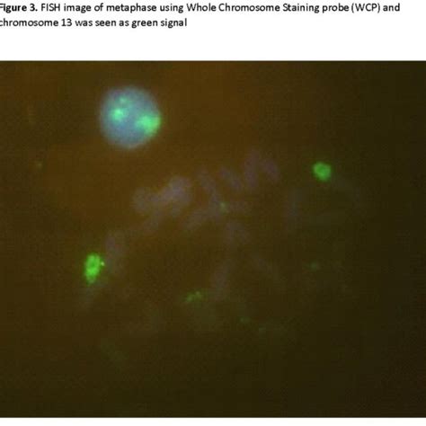 Fish Image Of Metaphase Using Whole Chromosome Staining Probe Wcp And