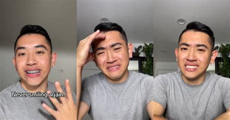 Al Quitarse Los Brackets Este Joven No Pudo Evitar Llorar ¡ahora Cree