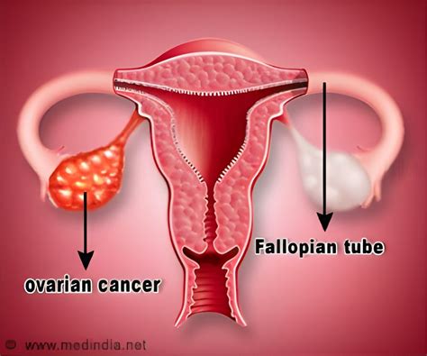 Fallopian Tube Tattoos
