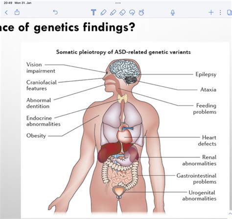 Atypical Development Lecture Karteikarten Quizlet