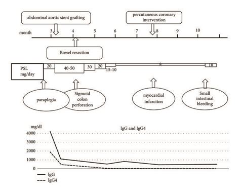 Progress Of Manifestations Igg Igg4 And Treatments Igg And Igg4