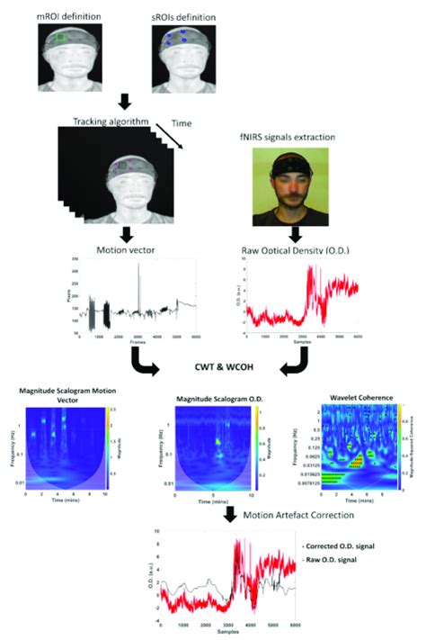 Procedure For Data Processing And Motion Artifacts Correction