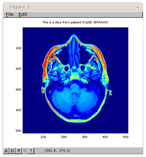 Interfacing With Matlab And Octave Orthanc Book Documentation