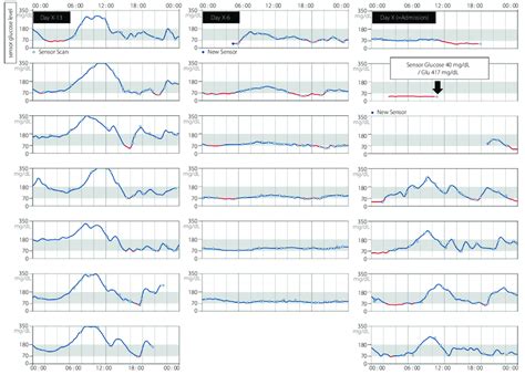 The Freestyle Libre Data 6 Days Prior To The Visit To The Hospital Download Scientific
