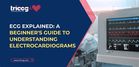 Ecg Explained A Beginners Guide To Understanding Electrocardiograms Tricog Health