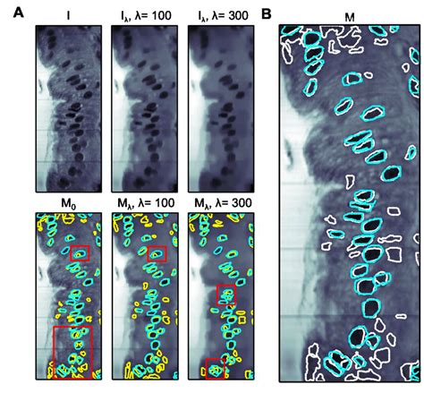 Image Denoising And Nuclei Segmentation A Top Row Left Raw Image I Download Scientific