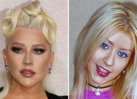 Christina Aguilera Plastic Surgery Her Several Surgeries