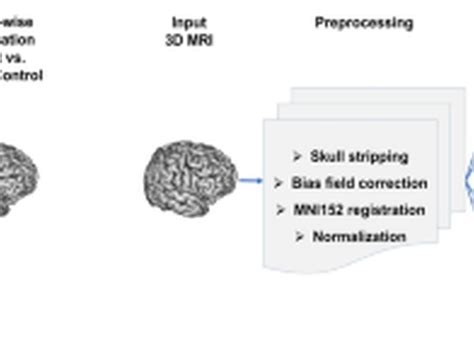 effects of mri scanner manufacturers in classification tasks with deep