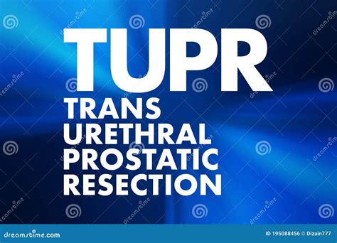 Transurethral Resection Of The Prostate Vector Illustration