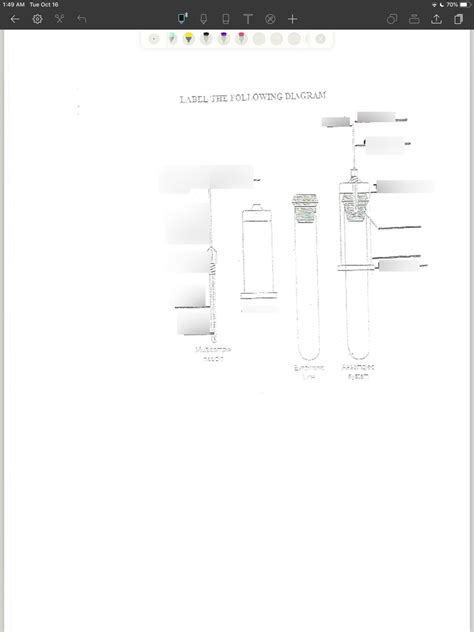Multi Sample Needle Diagram Quizlet