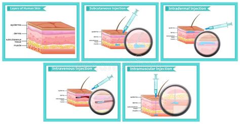 Types Of Injections On White Background Stock Vector Illustration Of