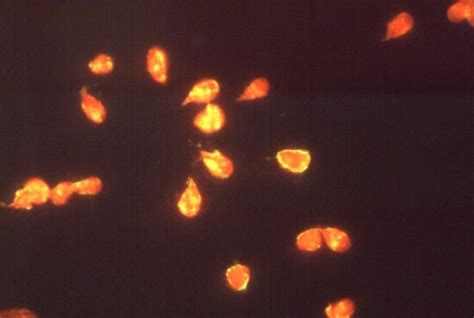 Free Picture Giardia Lamblia Parasites Immunofluorescence Test