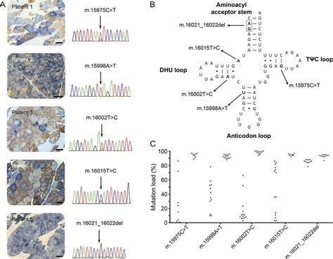 Histopathologic And Molecular Genetic Characterization Of 5 Pathogenic