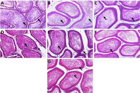 The Control Group A Had A Normal Testicular And Epididymis Structure
