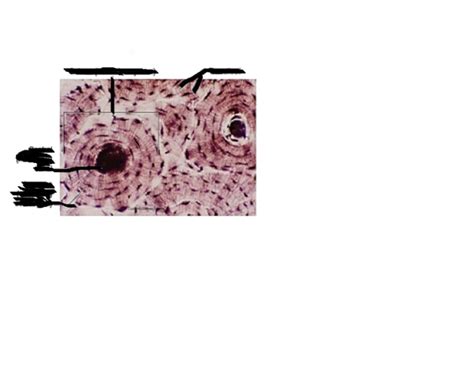 Compact Bone Label Zoomed In Quiz