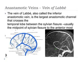 Venous Drainage Of The Brain Presentation Pptx Pptx