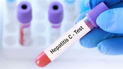 Everything You Need To Know About Hepatitis C Genotypes