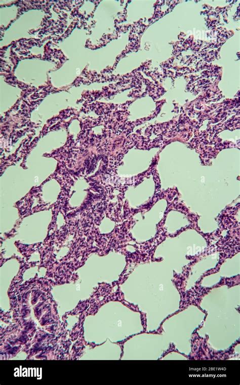 Lung Microscope Slide