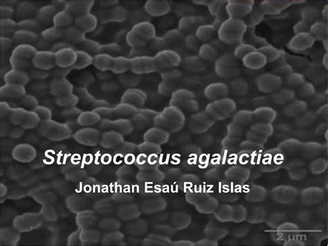 Streptococcus Agalactiae Ppt