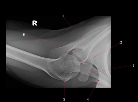 Axial Shoulder Xray Diagram Quizlet
