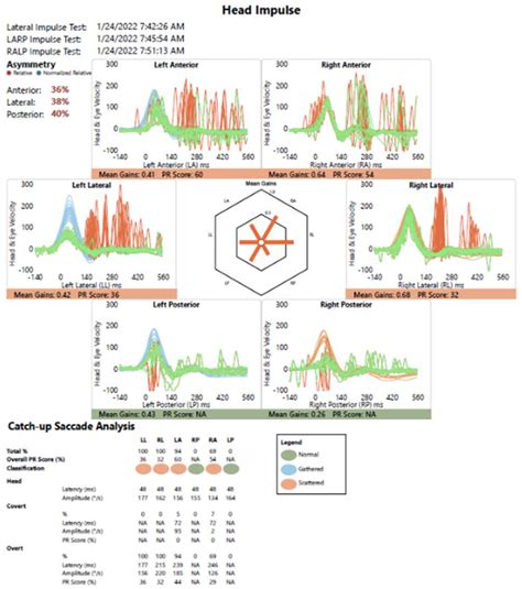 Video Head Impulse Testing January 2022 Download Scientific Diagram